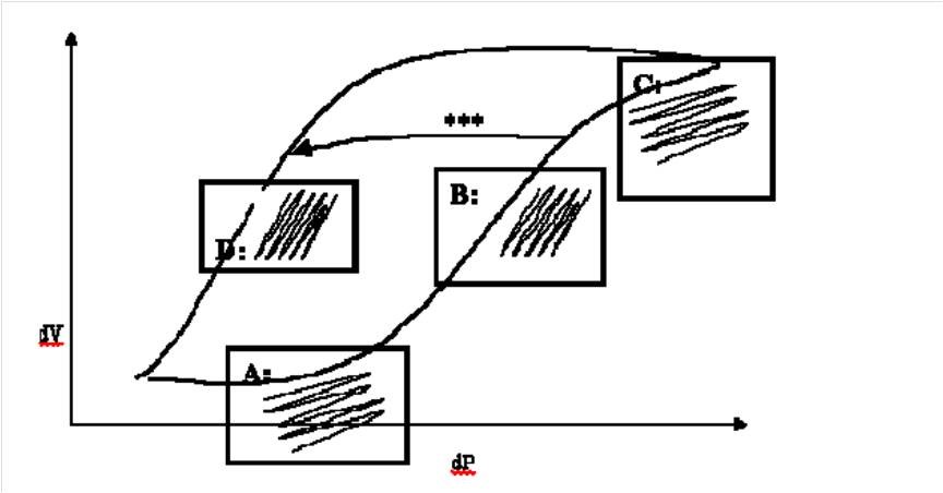 High Frequency Oscillatory Ventilation (HFOV) : a guide to the use of ...